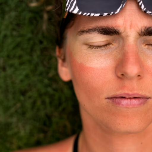 Topic- The Best Ways to Soothe Sunburn and Tanning – Lotus Professional